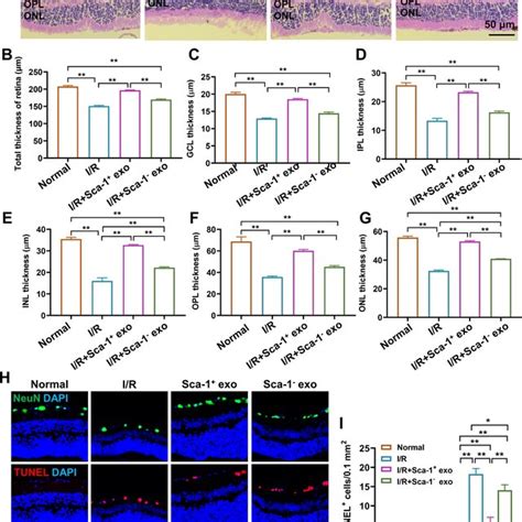 Sca 1⁺ Exosomes Protect Retinal Morphology By Reducing Ir Induced