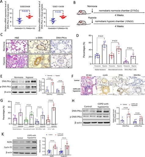 Dna Pkcs Up Regulated In Lung Tissues From Hph Rats And Copd Patients
