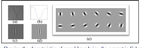 Figure 1 From Retinal Vessel Segmentation Using Gabor Filter And Textons Semantic Scholar