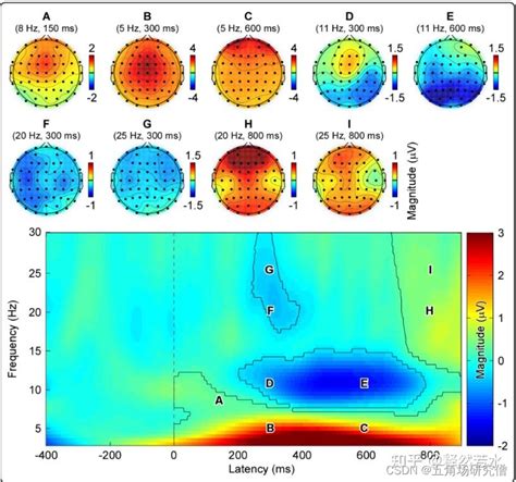 Eeg信号——时域分析、频域分析、时频分析 Csdn博客