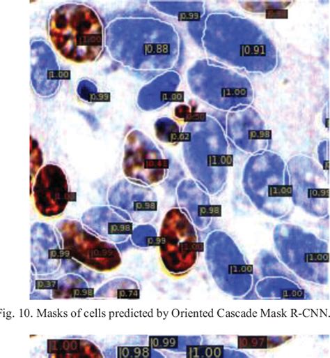 Figure 10 From Oriented Cascade Mask R Cnn For Biomedical Image