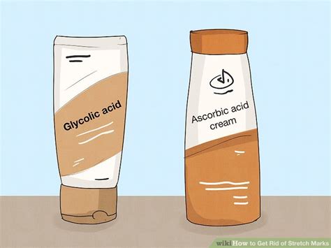 3 Ways To Get Rid Of Stretch Marks WikiHow