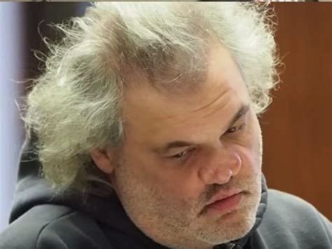What Happened To Artie Langs Nose Explora Madeira