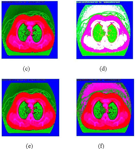 figure 2 from comparison of gradient operator based pseudocolored