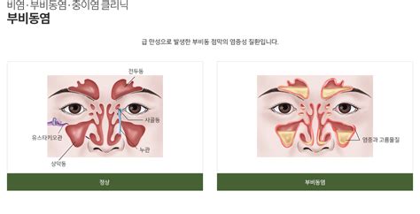 범미르부부한의원 비염·부비동염·중이염 클리닉