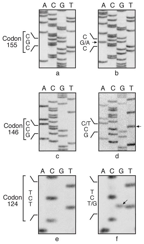 Examples Of Sequencing P53 Exon 5 Mutations In Lung Neoplasms From Download Scientific Diagram