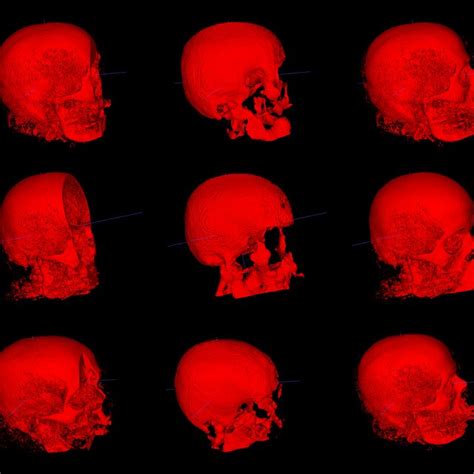 Reconstruction Of The Facial Defects Using The Pretrained Model The Download Scientific