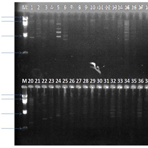 Plasmid Replicon Types Detected In Salmonella Isolates Download Scientific Diagram