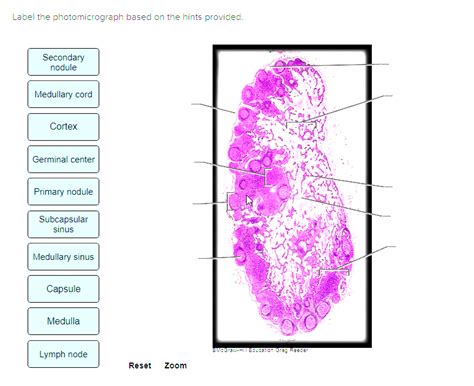 Label The Photomicrograph Based On The Hints Chegg Com