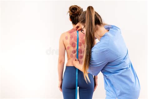 Vacuum Cupping Therapy Physiotherapist Working With Female Patient