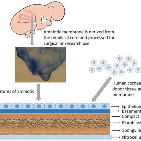 Biologically Derived Material Amniotic Membrane Is Excised From The Download Scientific