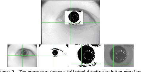 Figure 1 From A Robust And Accurate Detection Of Pupil Images