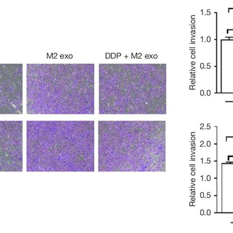 Cd163 Tams Exosomes M2 Exo Inhibited Adamts6 Expression Activated