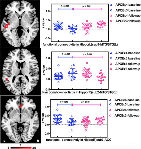Functional Connectivity Influenced By The Interaction Effect Of Apoe ε4