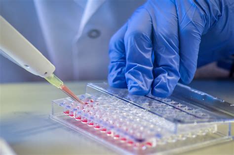 Immunogenicity Testing For Biosimilars Bioagilytix