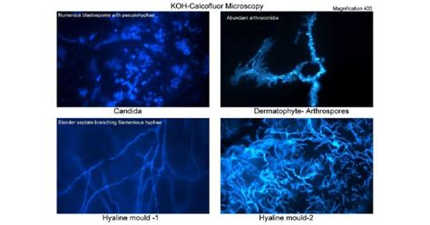 Fungal Staining Koh Calcofluor White And Interpretation Sean Schepers