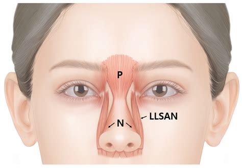 Novel Anatomical Guidelines On Botulinum Neurotoxin Injection For