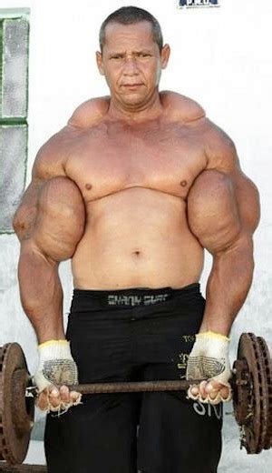 Do You Even Lift Bro Or Do You Inject Steroids And Synthol Gross Biceps Wtf Faxo