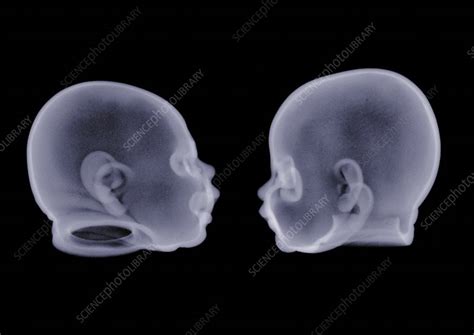 Two Doll Heads X Ray Stock Image F0299423 Science Photo Library