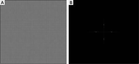 A Method For The Reconstruction Of Multifocal Structured Illumination Microscopy Data With High