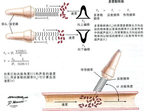 超声心动图