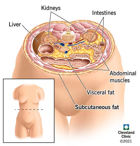 Subcutaneous Fat Surgery