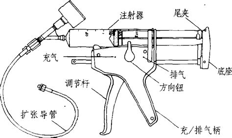 第四节 内镜直肠结肠良性狭窄球囊扩张术 外科学 医学