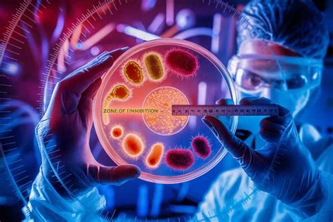 Novobiocin Susceptibility Test Principle Procedure