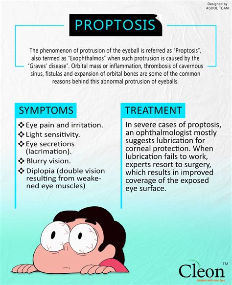 Asdol Proptosis The Phenomenon Of Protrusion Of The Eyeball Is Referred As “proptosis” Also