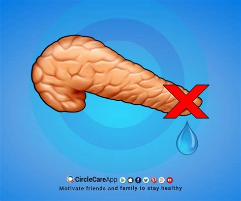 What Is Type 1 Diabetes CircleCare