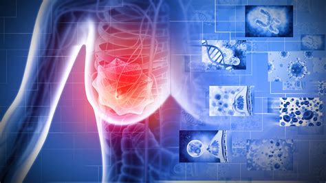 Chemoembolization Interventional Radiology Penn Medicine