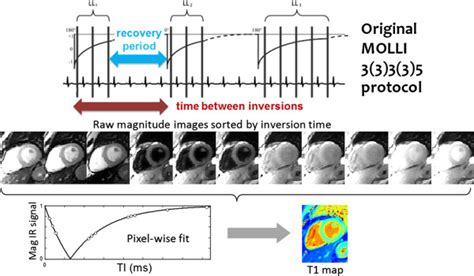 Modified Look Locker Inversion Recovery Molli Scheme For T1 Mapping Download Scientific