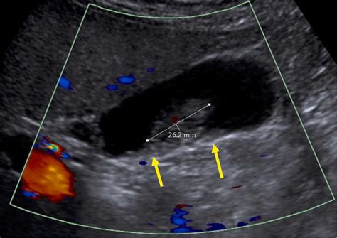 Follow Up Imaging And Surgical Costs Associated With Different