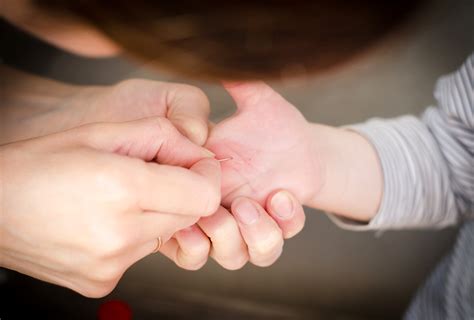 9 Ways To Remove A Splinter Safely At Home EMediHealth