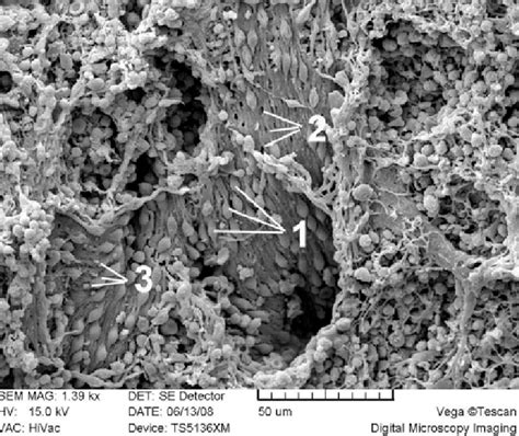 Venous Sinus In Sem Nuclei And Perinuclear Cytoplasms Of Sinus Lining