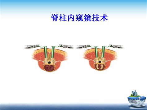 文章详情