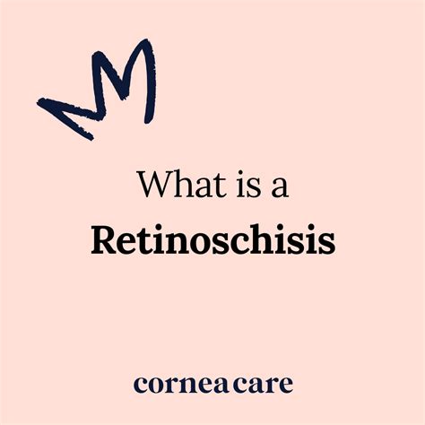 Retinoschisis Definition Corneacare