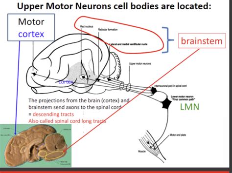 VM 602 Neurobiology Lecture 14 UMN And Descending Tract System