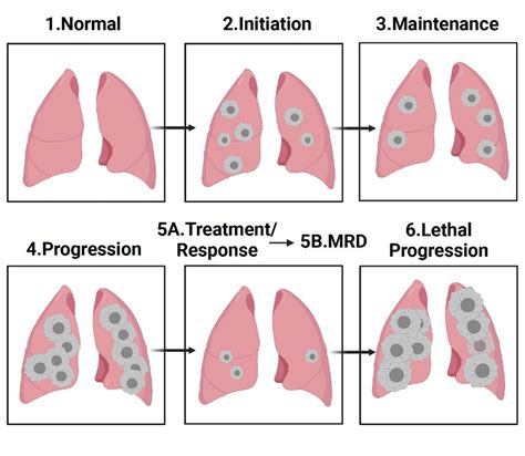 Research In The Vaishnavi Laboratory Md Anderson Cancer Center