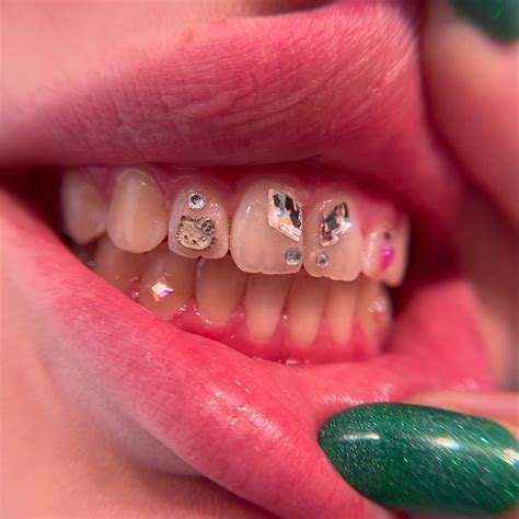 Hello Kitty Tooth Gems Tooth Gem Teeth Jewelry Pretty Teeth