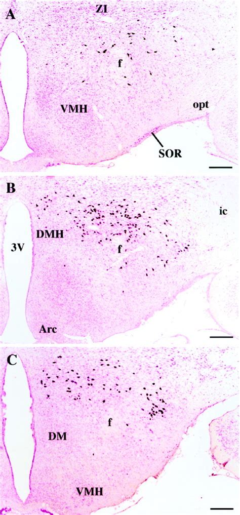Neurons Containing Hypocretin Orexin Project To Multiple Neuronal Systems Pmc