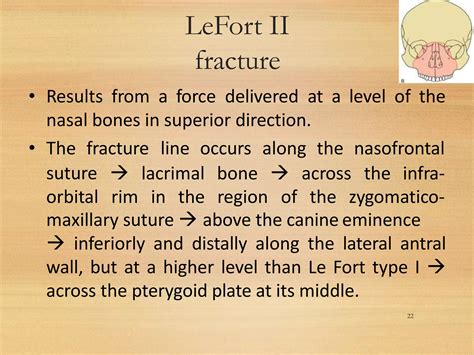 Le Fort Fractures Pdf