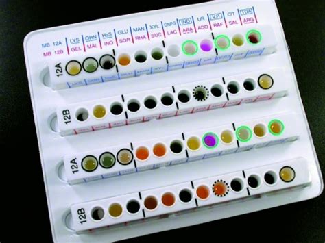 Identification Of Clinically Significant Micro Organisms Scientist Live