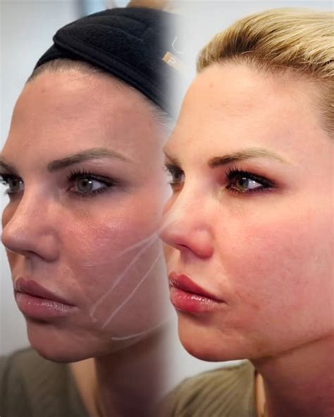 Pdo Threads Lily Pad Aesthetics