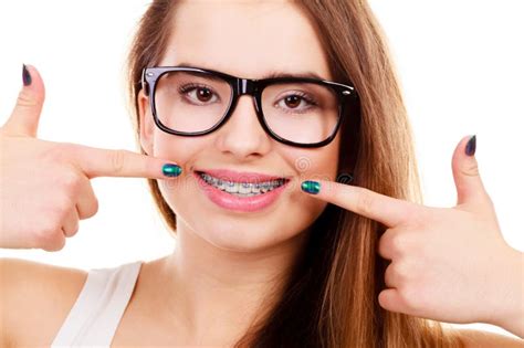Nerdy Woman Showing Her Teeth With Braces Stock Image Image Of Face Tooth 105716331