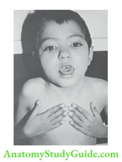 Differential Diagnosis Of Common Abnormal Physical Signs Notes Artofit