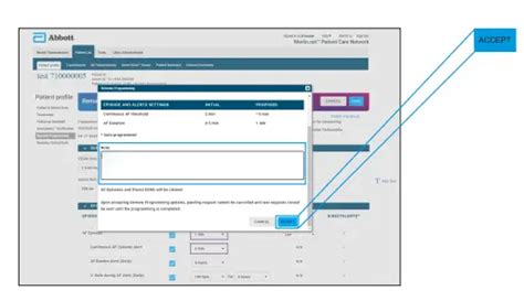 Abbott Assert Iq Einsteckbarer Herzmonitor Benutzerhandbuch