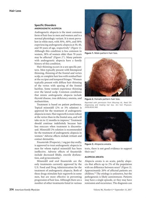 Hair Loss Common Causes And Treatment Pdf
