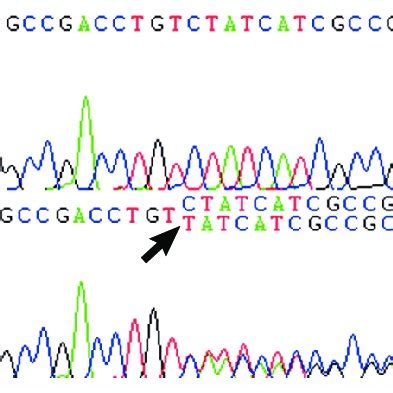 Sequencing Of Exon In The MEN Gene Showed A Frameshift Mutation Download Scientific Diagram