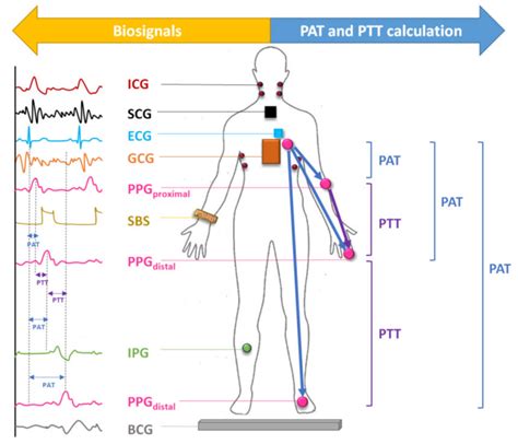 Determination Of Pulse Arrival Time And Pulse Transit Time In Various